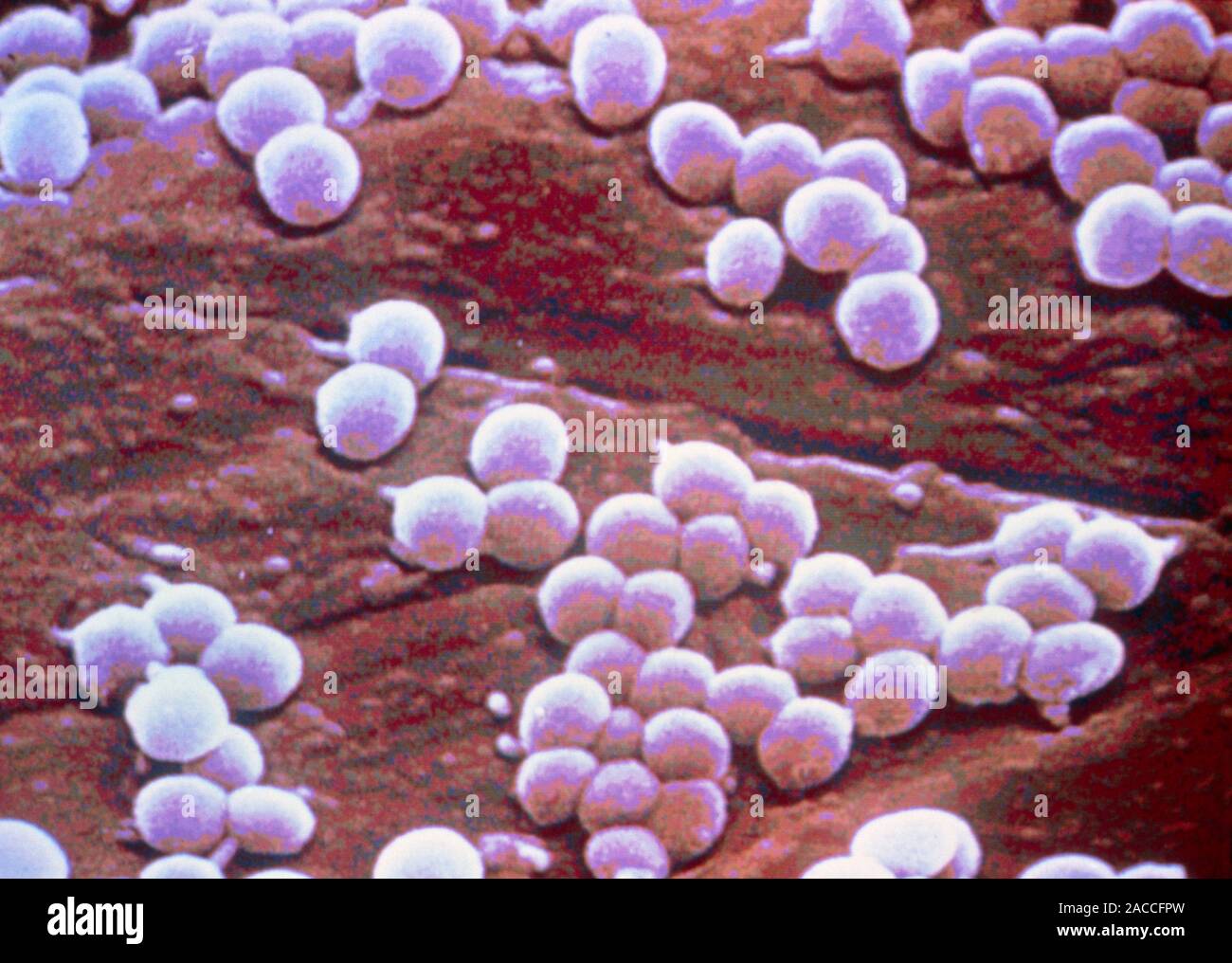 False-colour scanning electron micrograph (SEM) of Staphylococcus ...