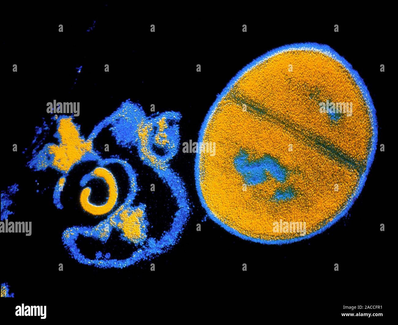 False Colour Transmission Electron Micrograph Tem Showing The Effect Of An Antibiotic On The