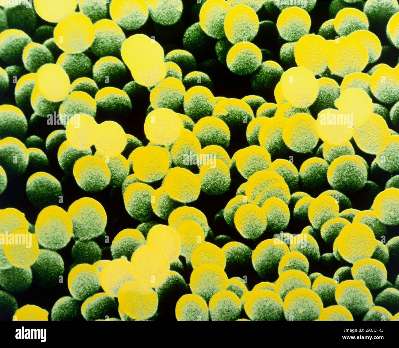 False-colour scanning electron micrograph (SEM) of the spherical ...