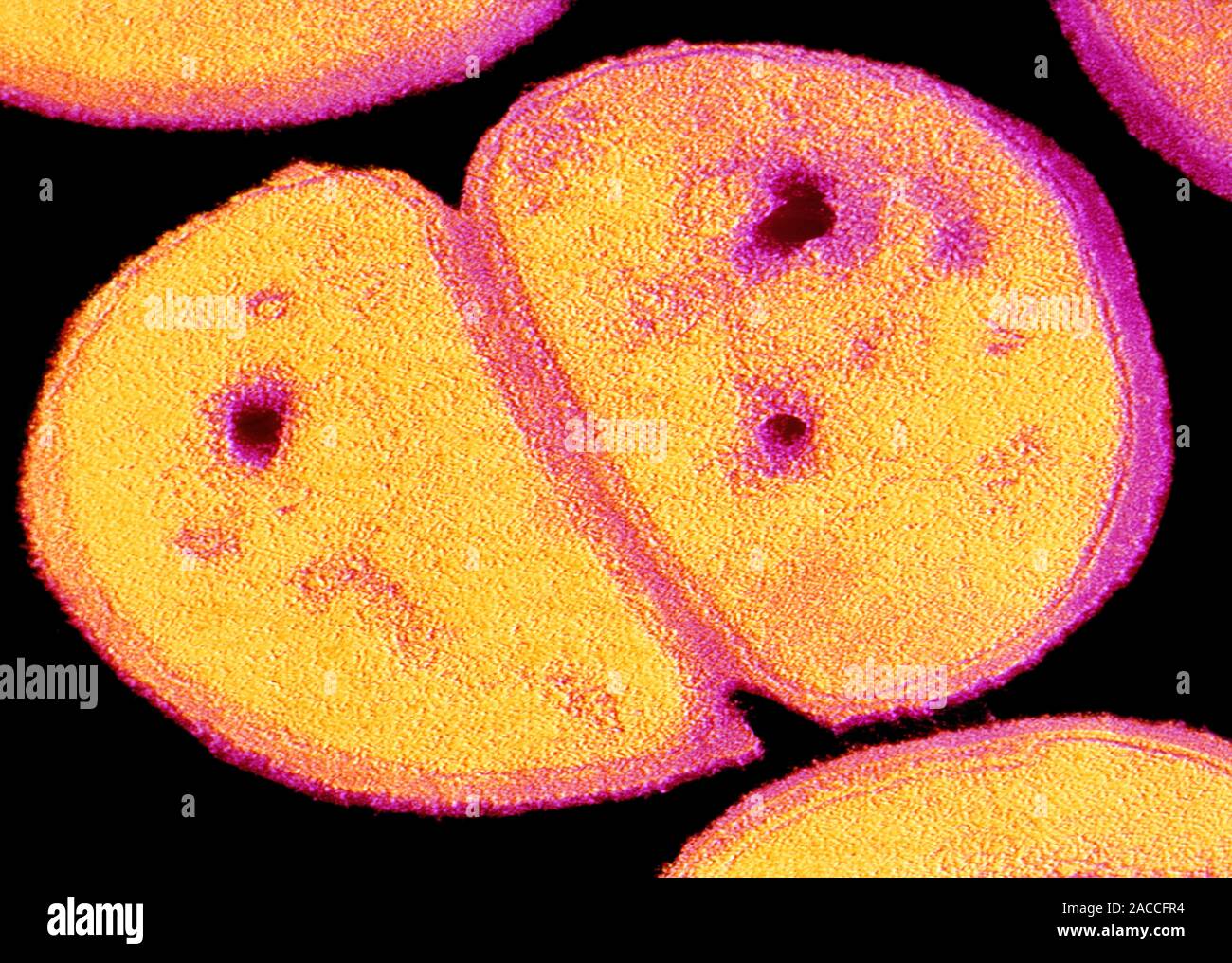 False Colour Transmission Electron Micrograph Tem Of Staphylococcus Aureus Showing A