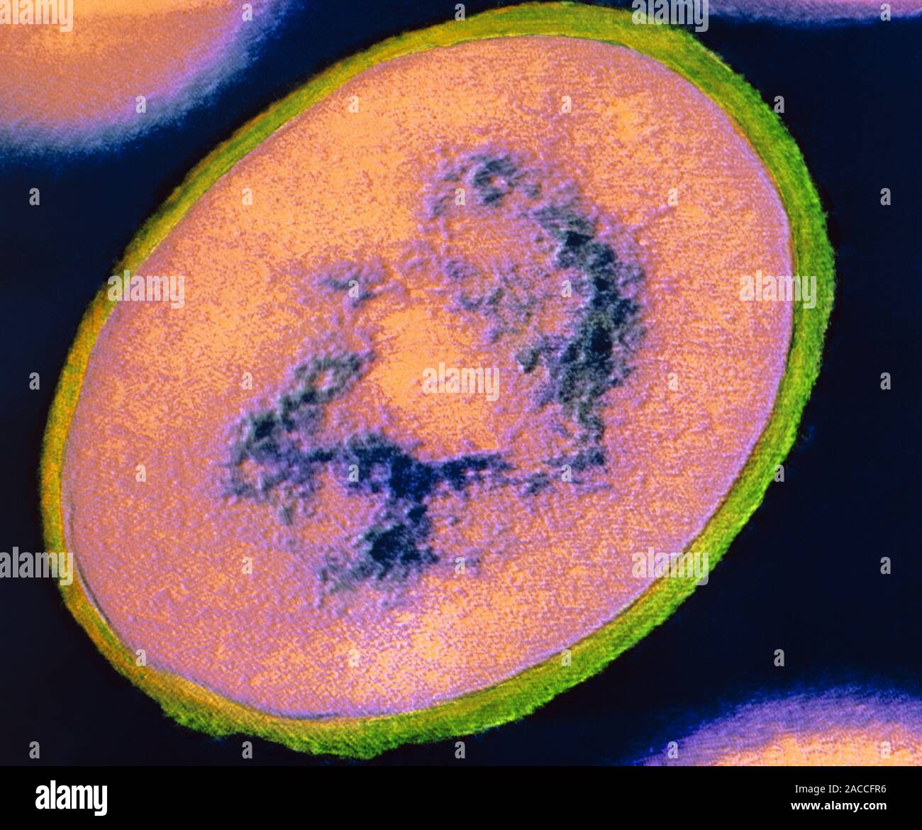 False Colour Transmission Electron Micrograph Tem Of An Individual Bacterium Of The Species