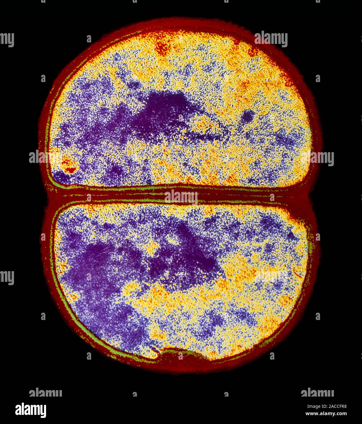 False-colour transmission electron micrograph of the spherical ...