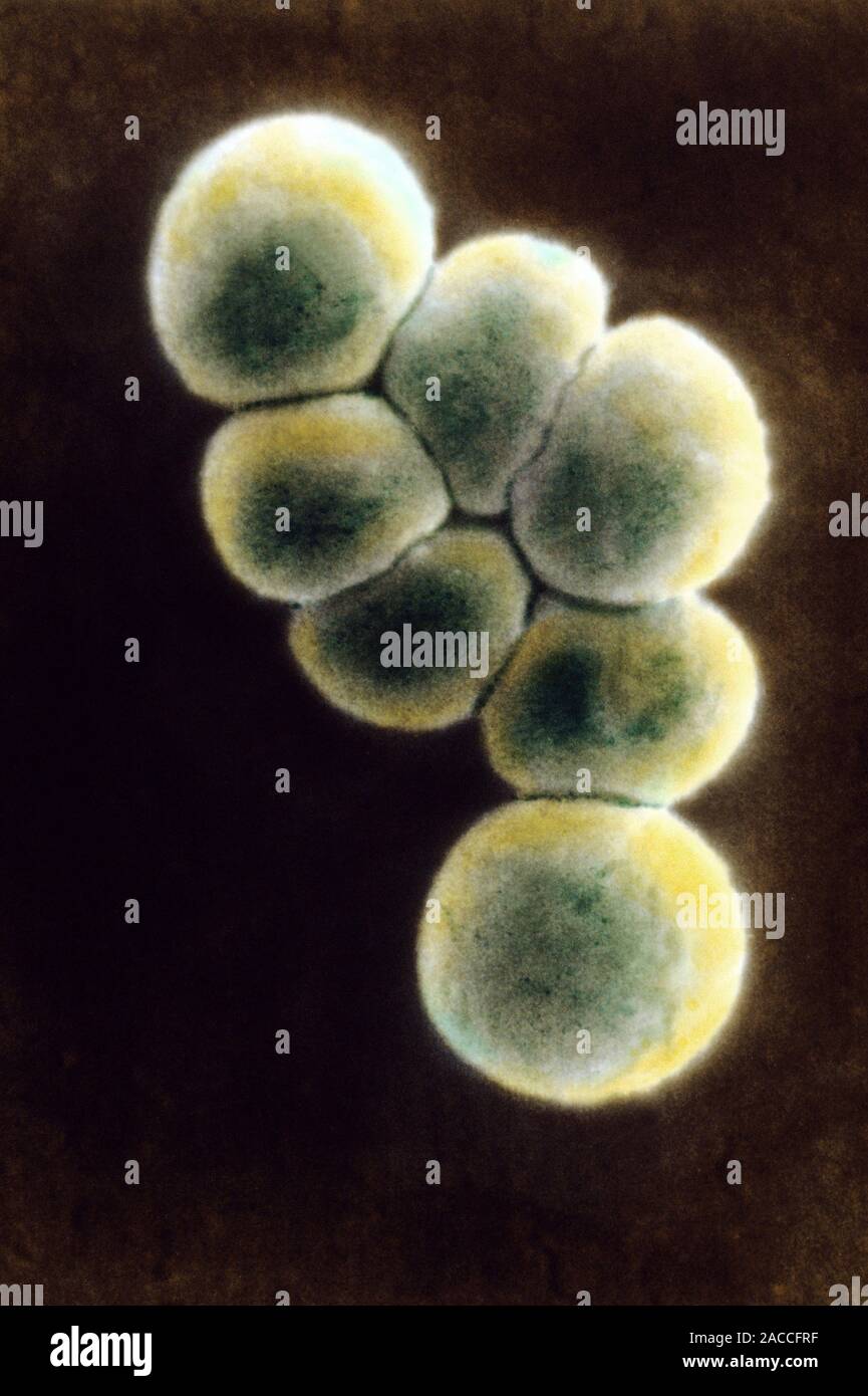 Staphylococcus aureus. Coloured Scanning Electron Micrograph (SEM) of a ...