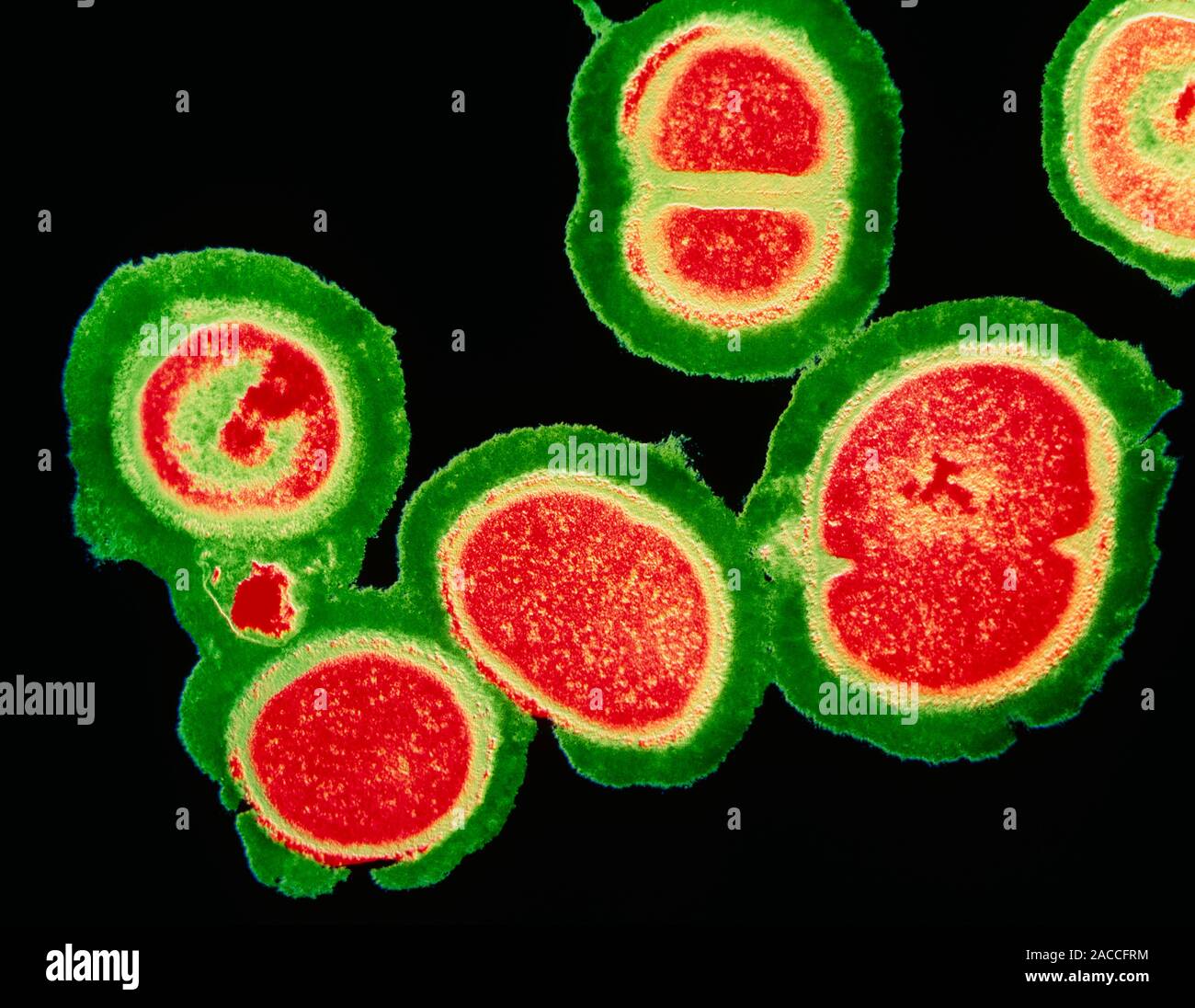 MRSA: resistant Staphylococcus bacteria. Coloured transmission electron ...
