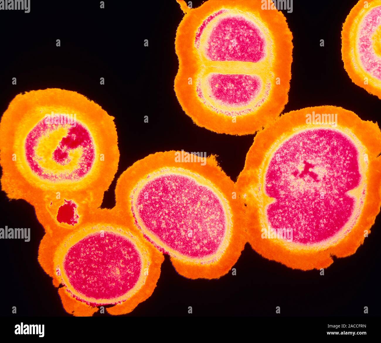 MRSA: resistant Staphylococcus bacteria. Coloured transmission electron ...