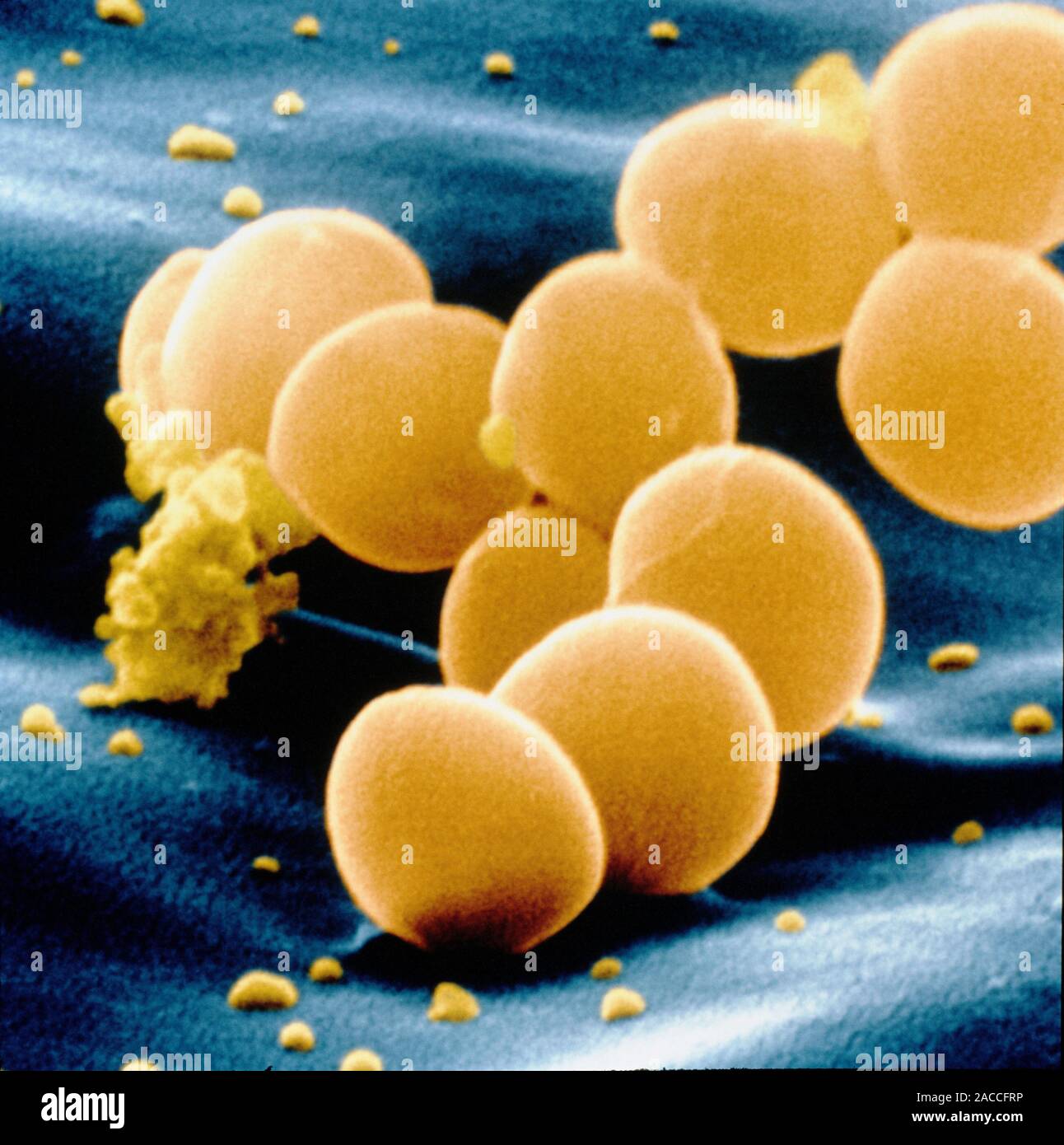 Scanning Electron Micrograph (SEM) of a cluster of Staphylococcus ...