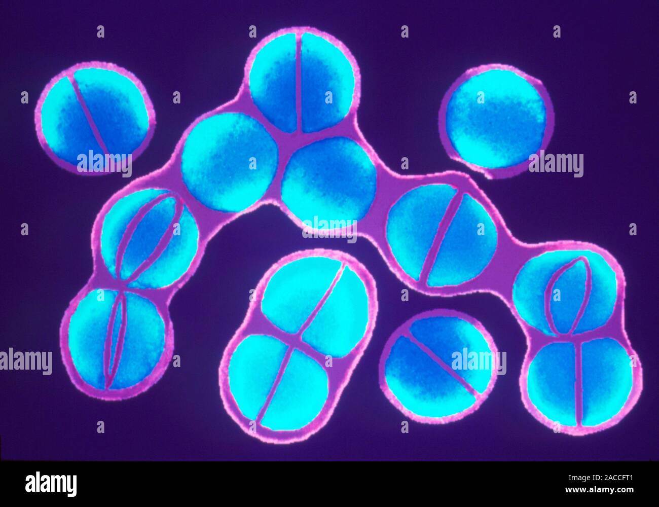 Staphylococcus bacteria. Coloured transmission electron micrograph (TEM ... Staphylococcus bacteria. Coloured transmission electron micrograph (TEM ...