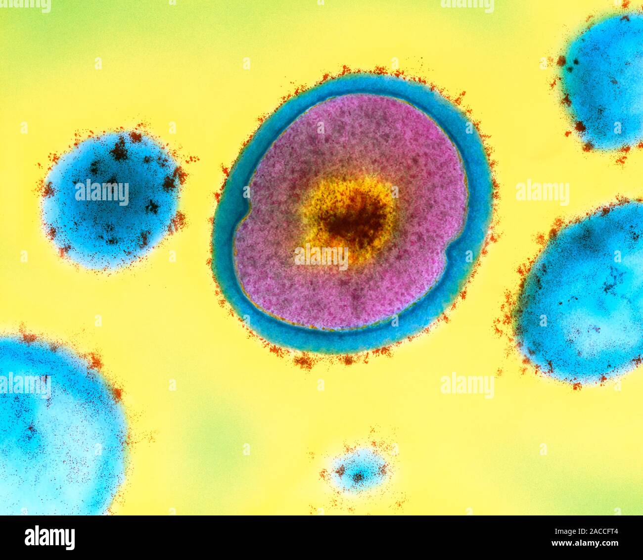 Staphylococcus bacteria. Colour transmission electron micrograph of ...