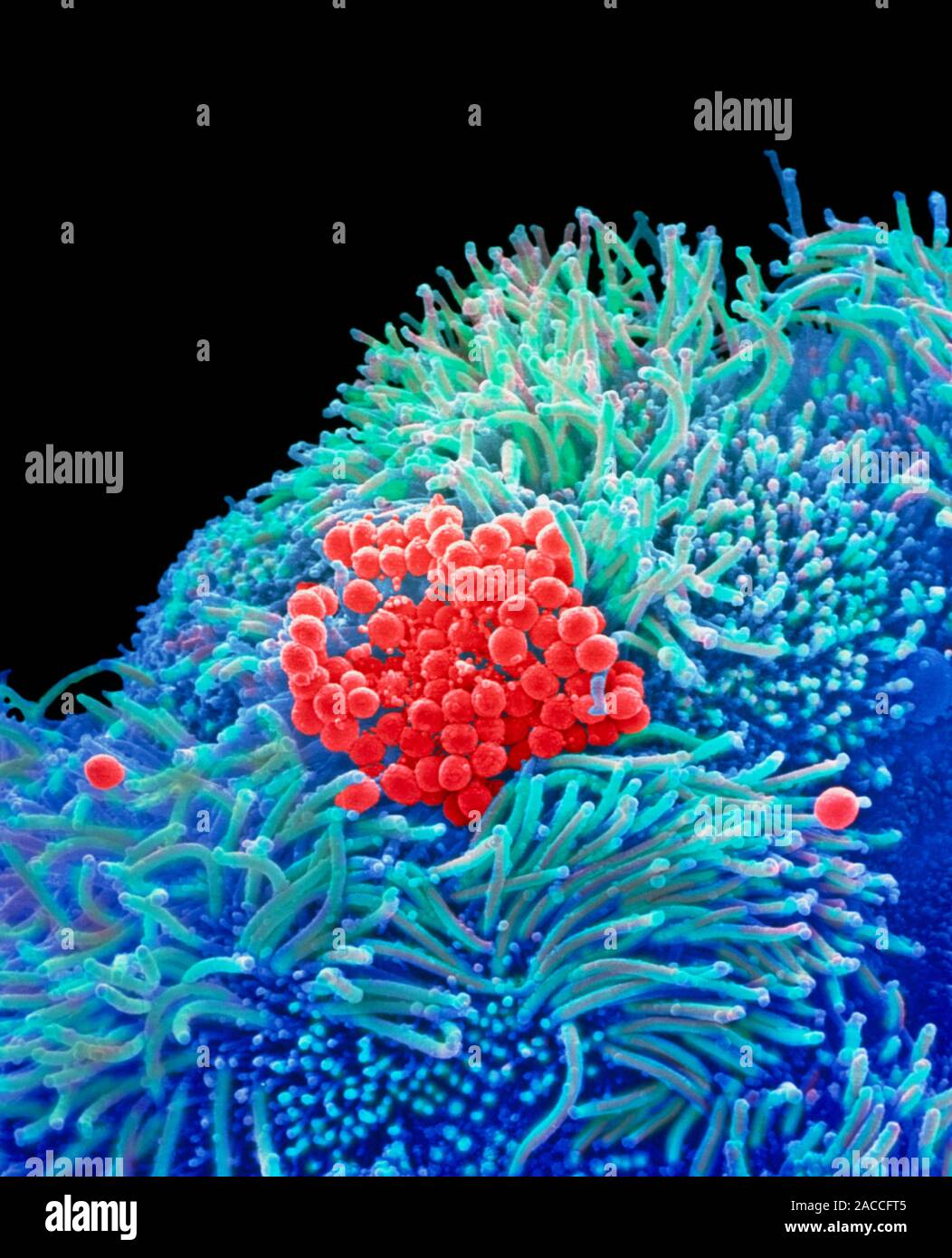 Staphylococcus sp. Coloured scanning electron micrograph (SEM) of a ...