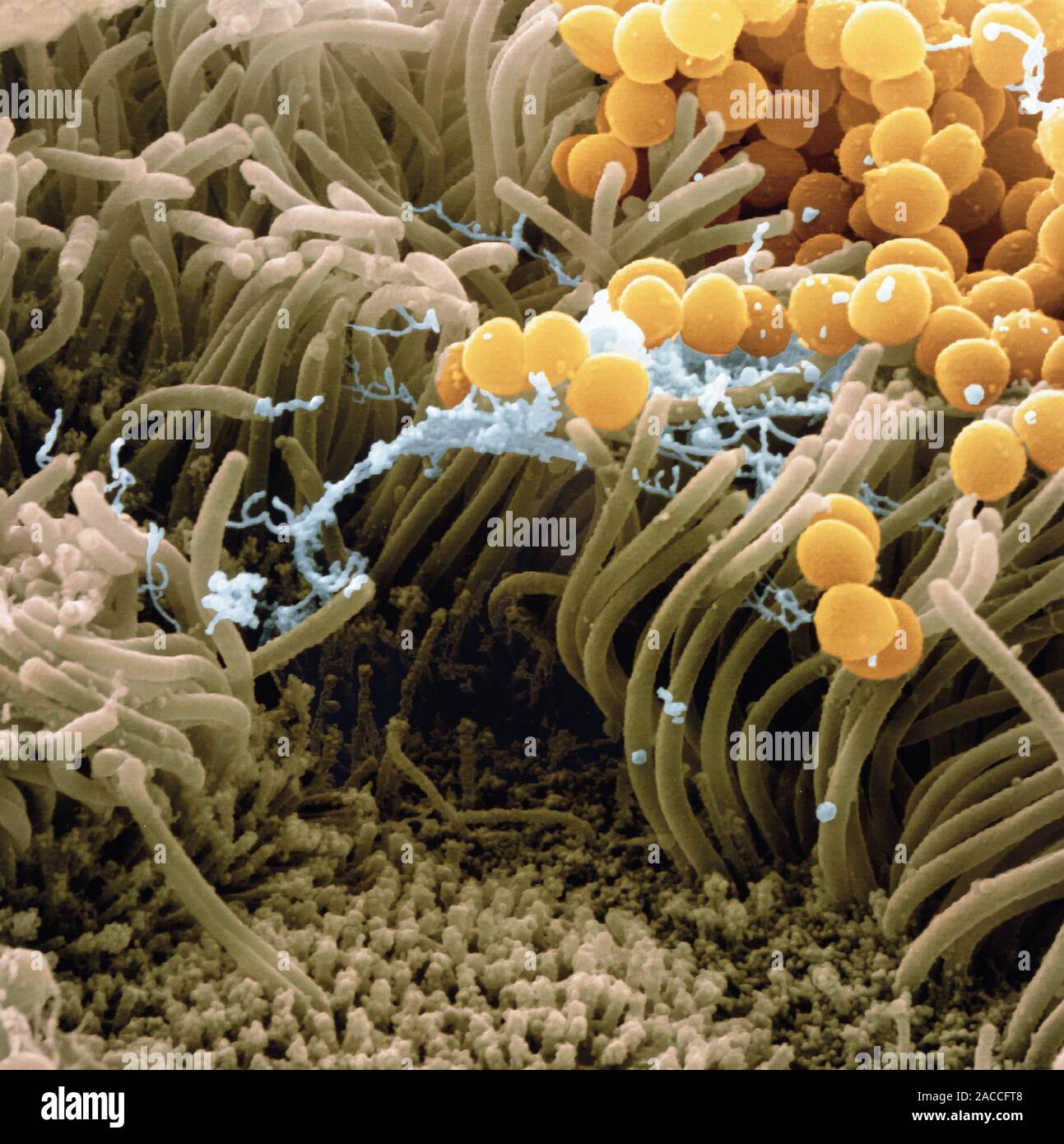 Staphylococcus bacteria. Coloured scanning electr- on micrograph (SEM ...