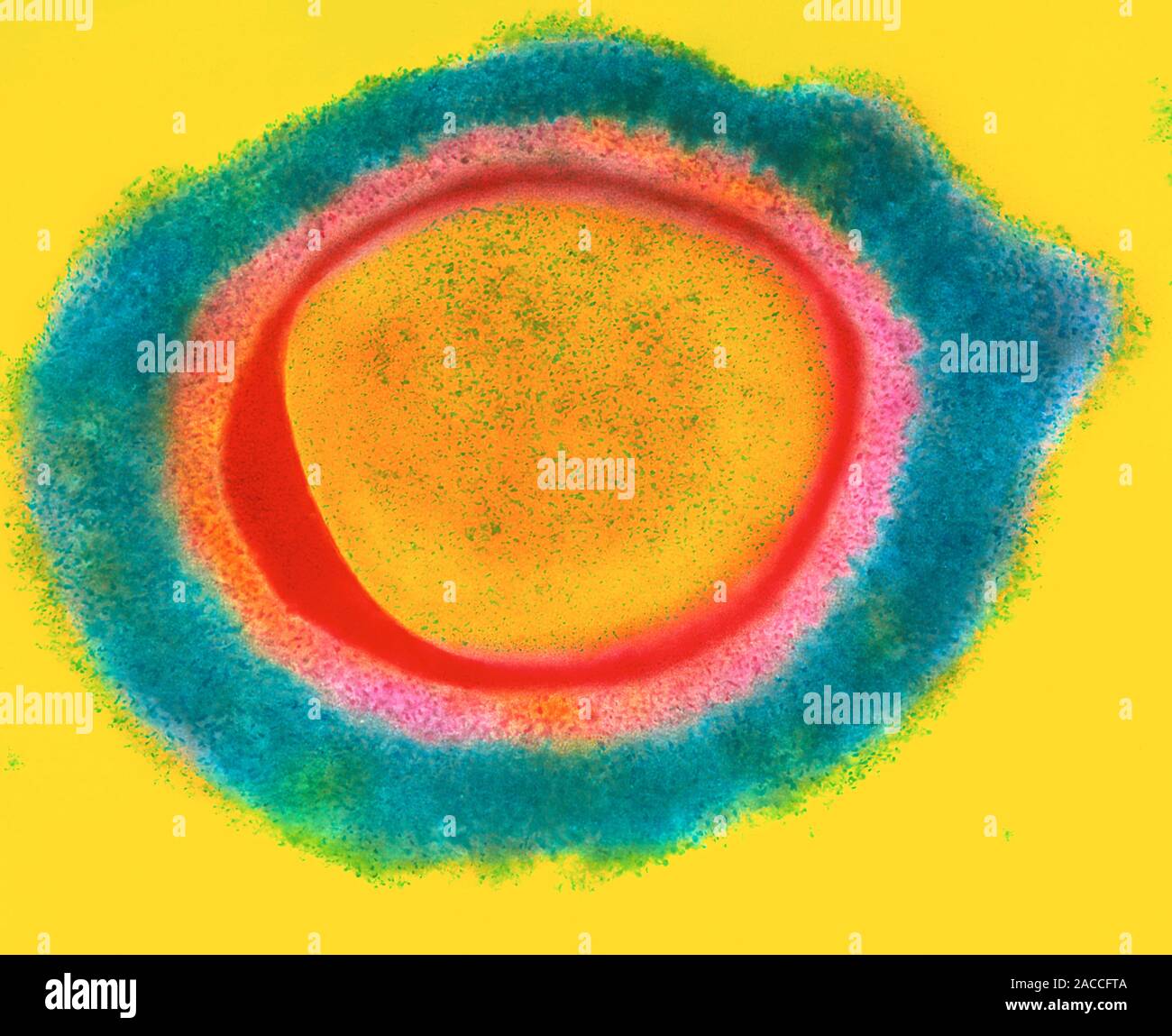 MRSA: antibiotic resistant bacteria. Coloured transmission electron ...