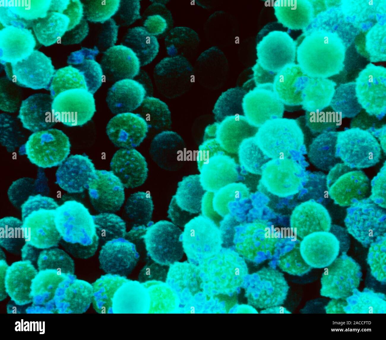 Staphylococcus aureus. Coloured scanning electron micrograph (SEM) of ...