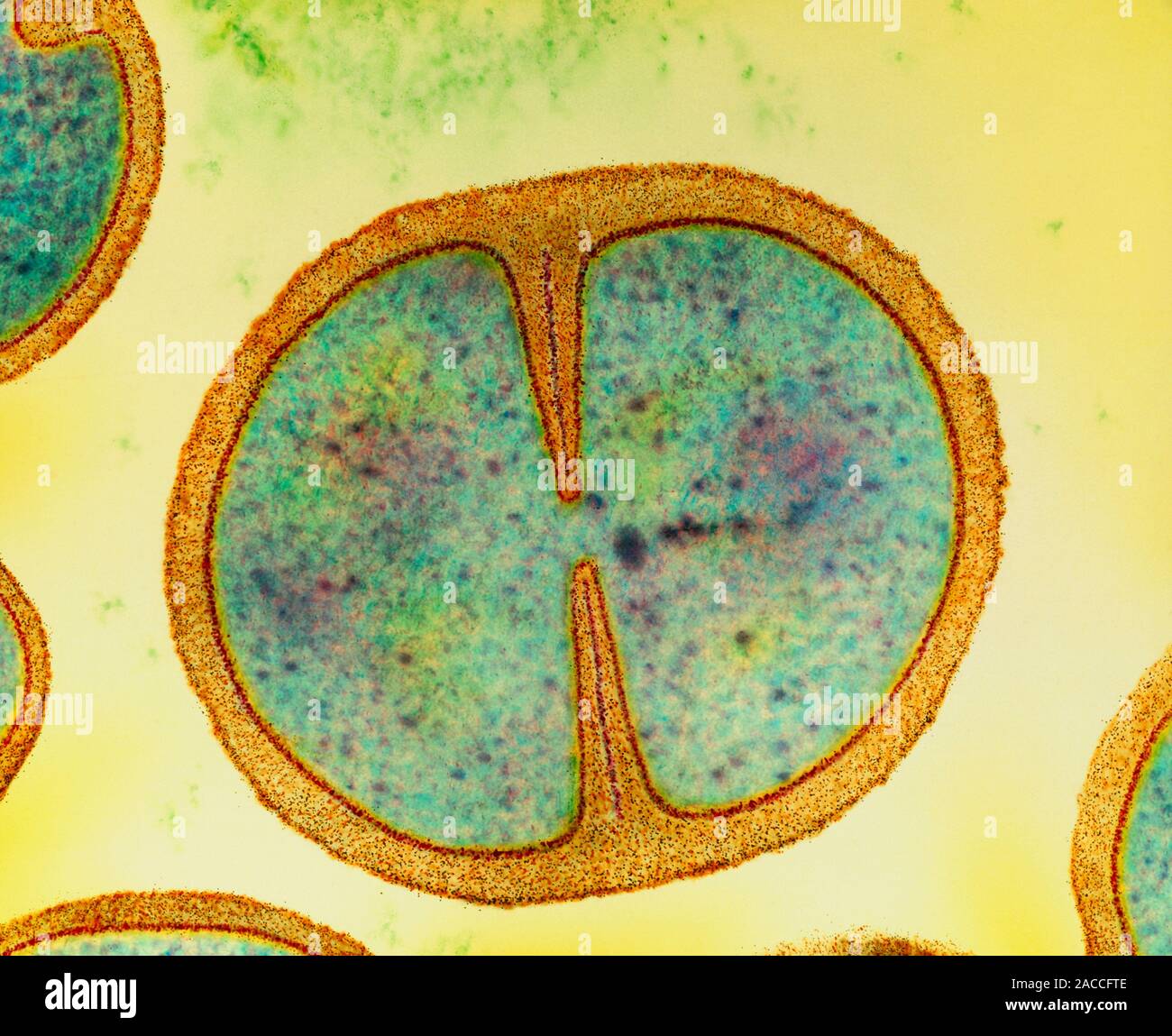 Staphylococcus epidermidis bacteria. Coloured transmission electron ...