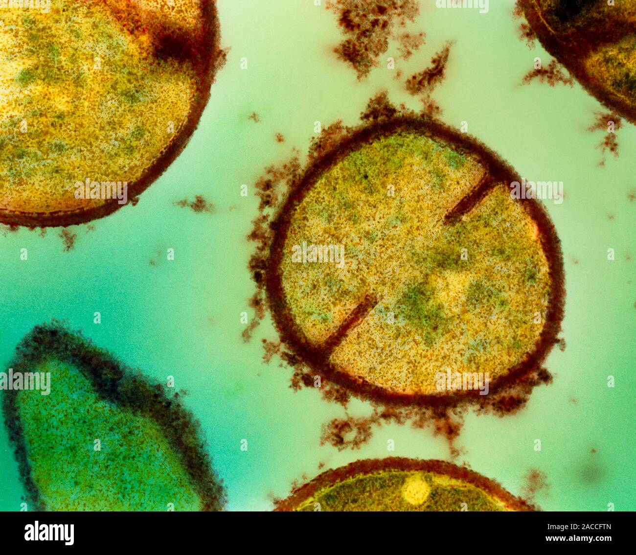 Staphylococcus bacteria. Coloured transmission electron micrograph (TEM ... Staphylococcus bacteria. Coloured transmission electron micrograph (TEM ...