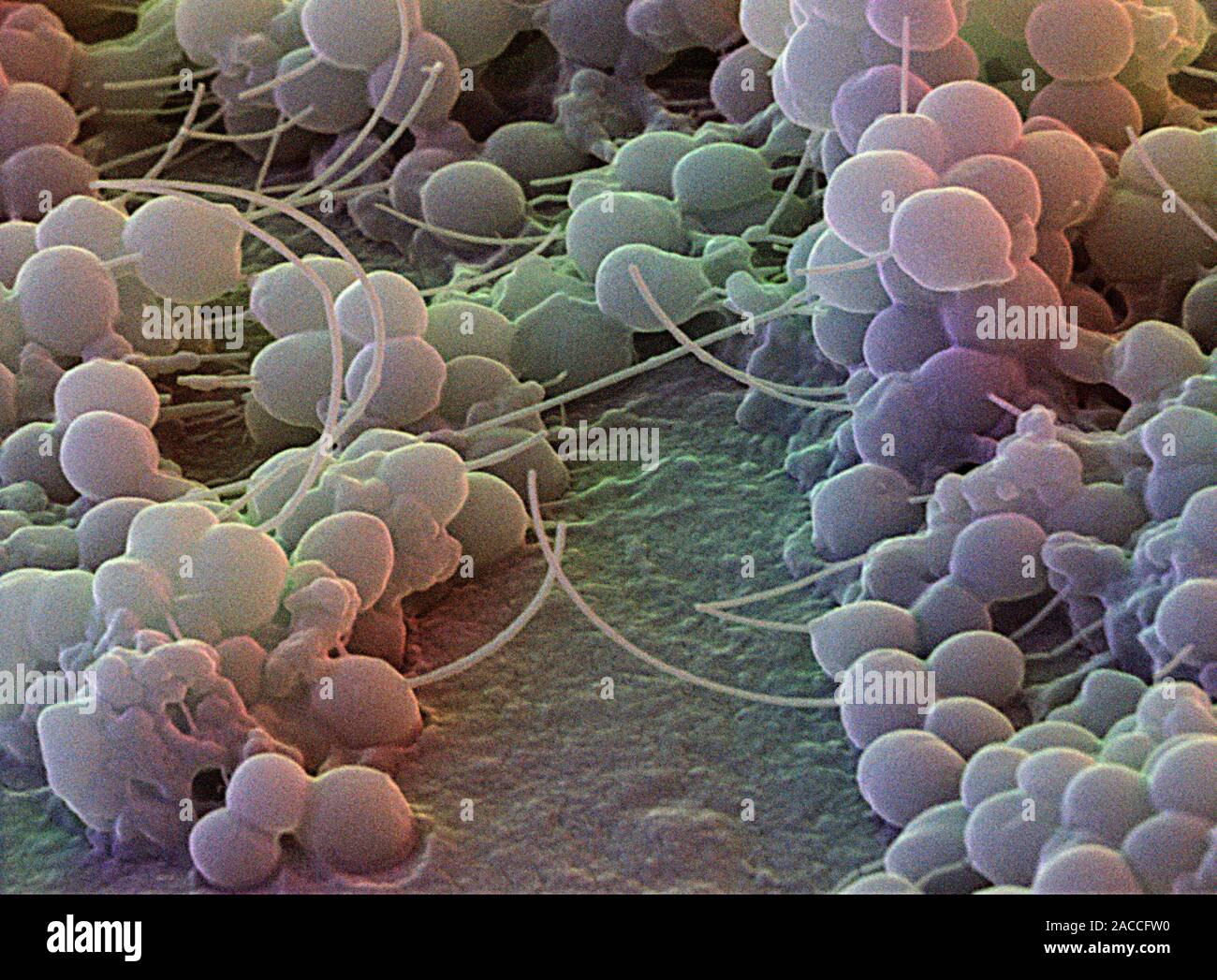 Staphylococcus epidermidis bacteria. Coloured scanning electron ...