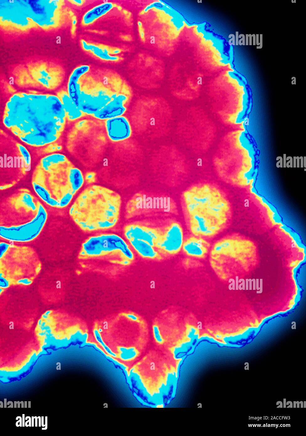 Staphylococcus aureus bacteria. Coloured trans- mission electron ...