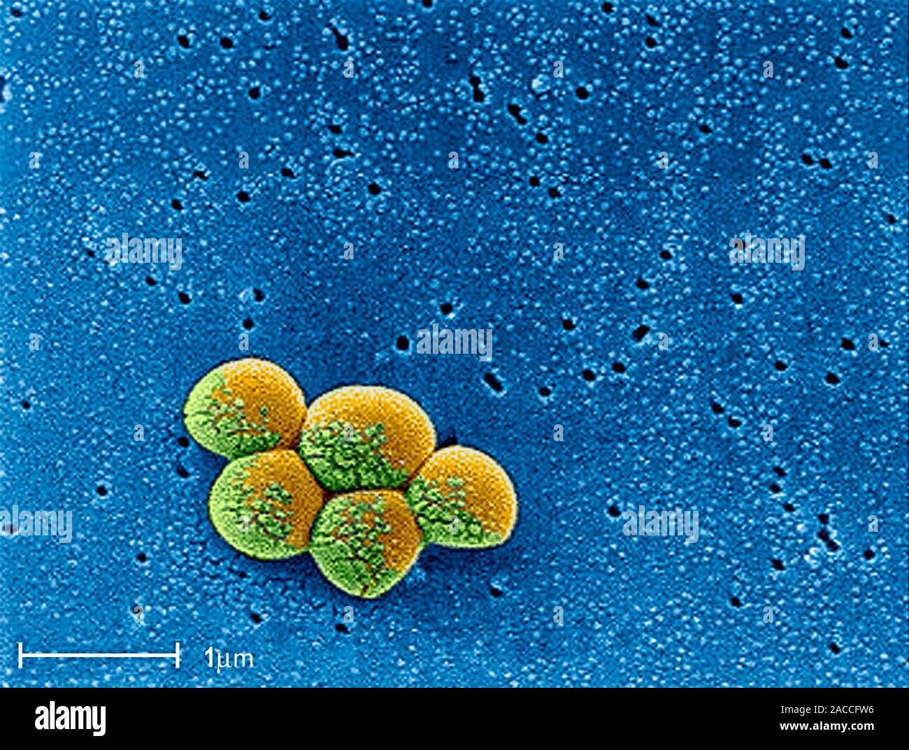 MRSA drug-resistant bacteria. Coloured scanning electron micrograph (SEM) of a group of ...