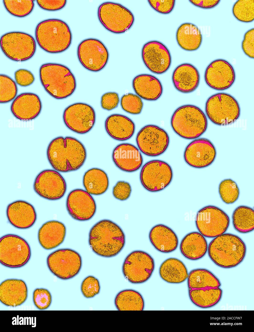 Mrsa Bacteria Coloured Transmission Electron Micrograph Tem Methicillin Resistant