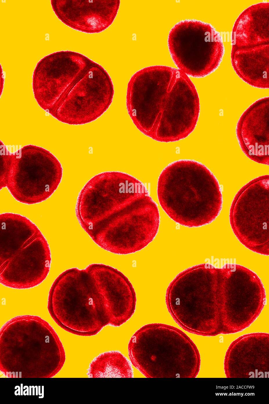 MRSA bacteria. Coloured transmission electron micrograph (TEM) of ... MRSA bacteria. Coloured transmission electron micrograph (TEM) of ...