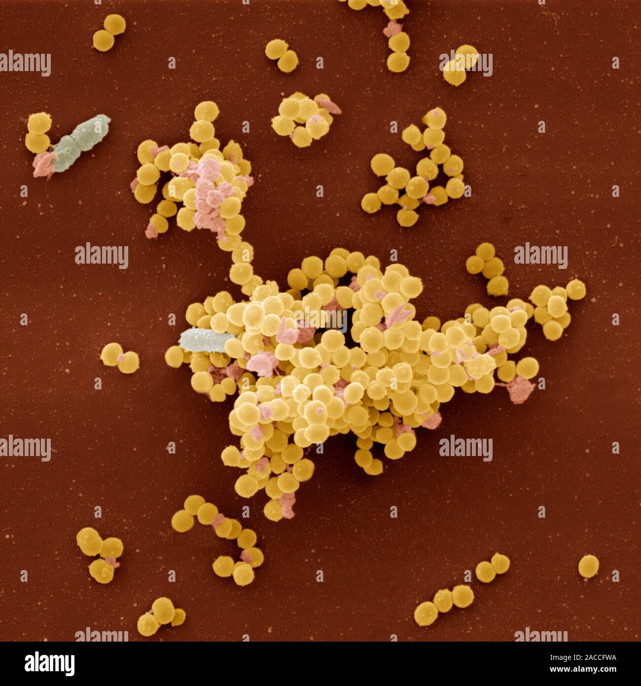 Staphylococcus aureus bacteria. Coloured scanning electron micrograph ... Staphylococcus aureus bacteria. Coloured scanning electron micrograph ...