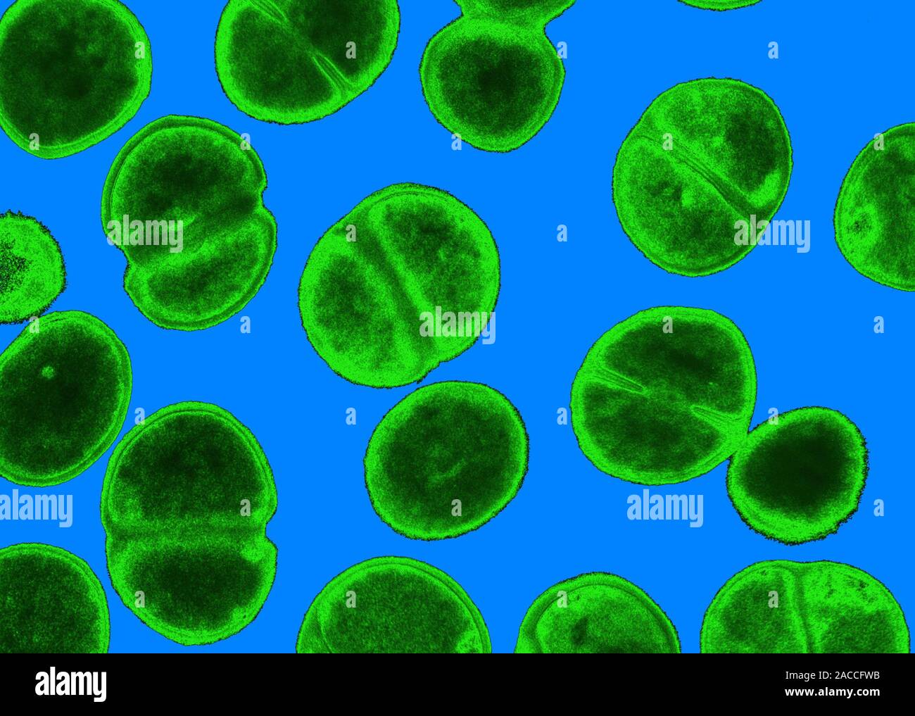 MRSA bacteria. Coloured transmission electron micrograph (TEM) of ...