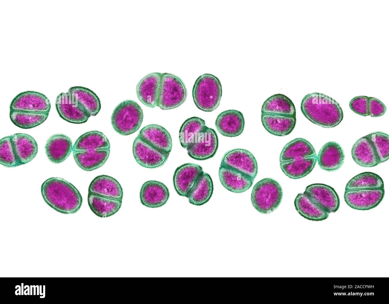 MRSA bacteria. Coloured transmission electron micrograph (TEM) of ...