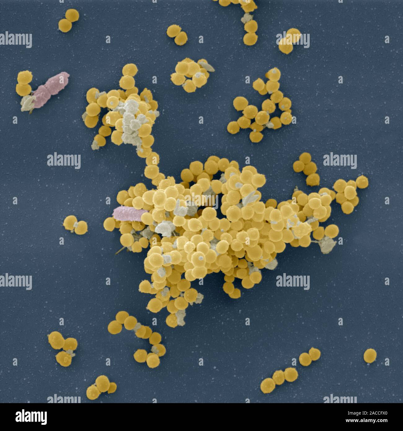 Staphylococcus aureus bacteria, coloured scanning electron micrograph ...