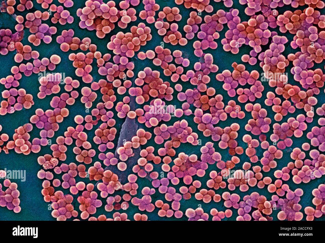 MRSA bacteria, coloured scanning electron micrograph (SEM). Methicillin-resistant Staphylococcus ...