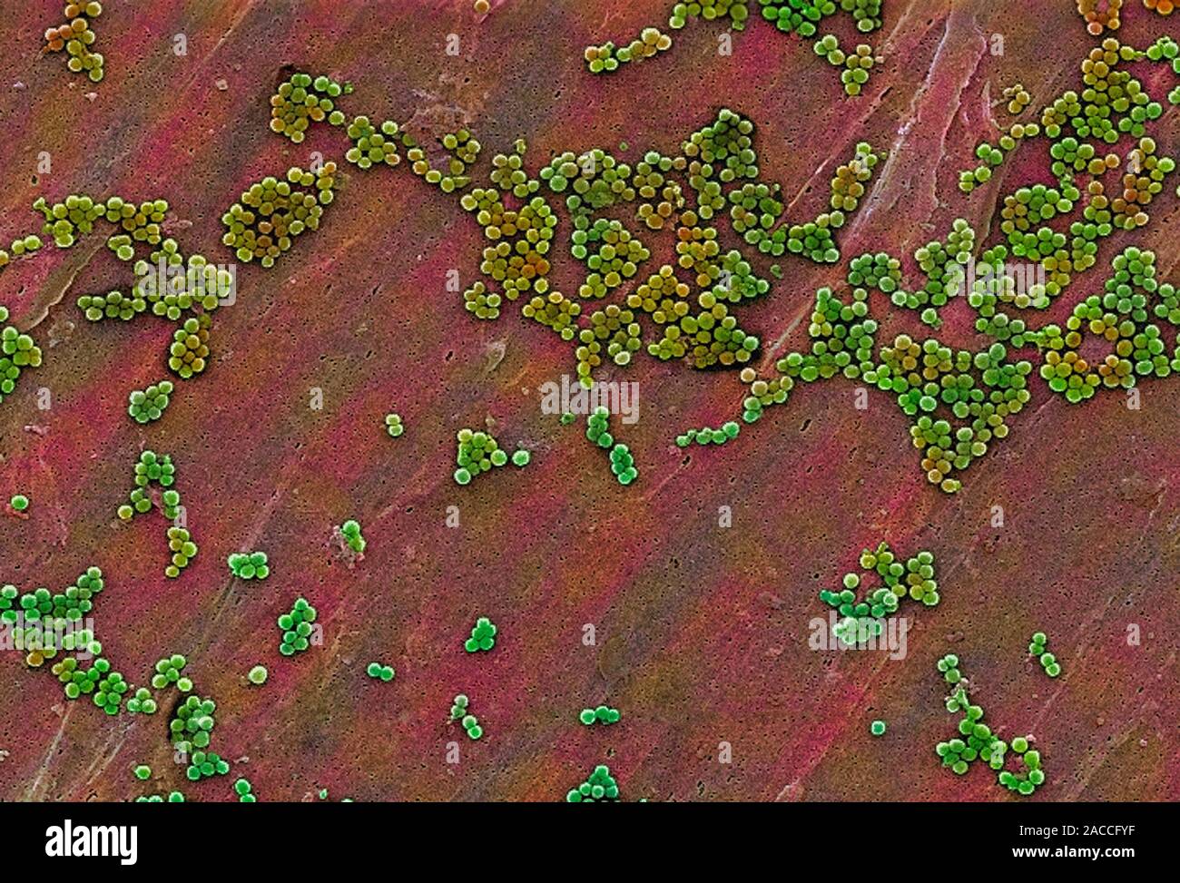 MRSA bacteria, coloured scanning electron micrograph (SEM). Methicillin-resistant Staphylococcus ...