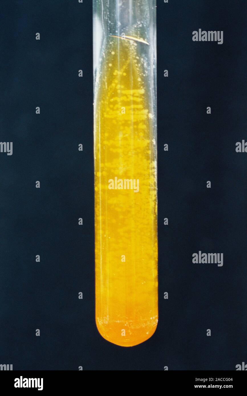 Staphylococcus aureus culture. Test-tube containing S. aureus bacteria ...
