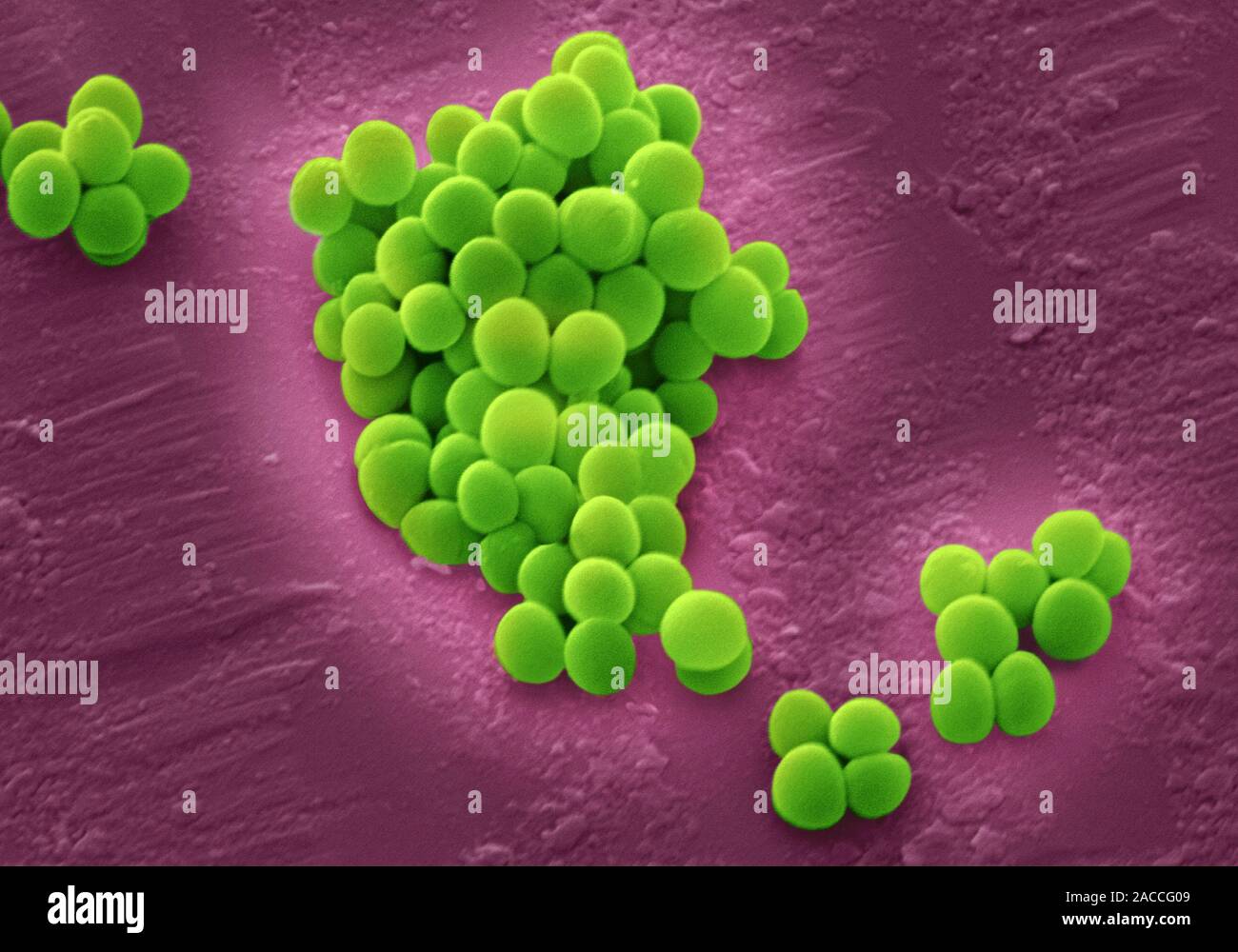MRSA bacteria, coloured scanning electron micrograph (SEM). Methicillin ... MRSA bacteria, coloured scanning electron micrograph (SEM). Methicillin ...
