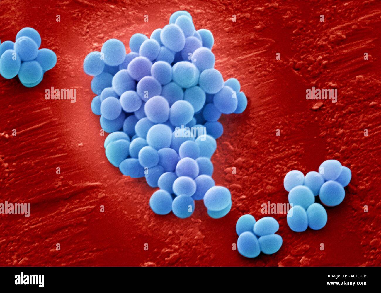 MRSA bacteria, coloured scanning electron micrograph (SEM). Methicillin-resistant Staphylococcus ...