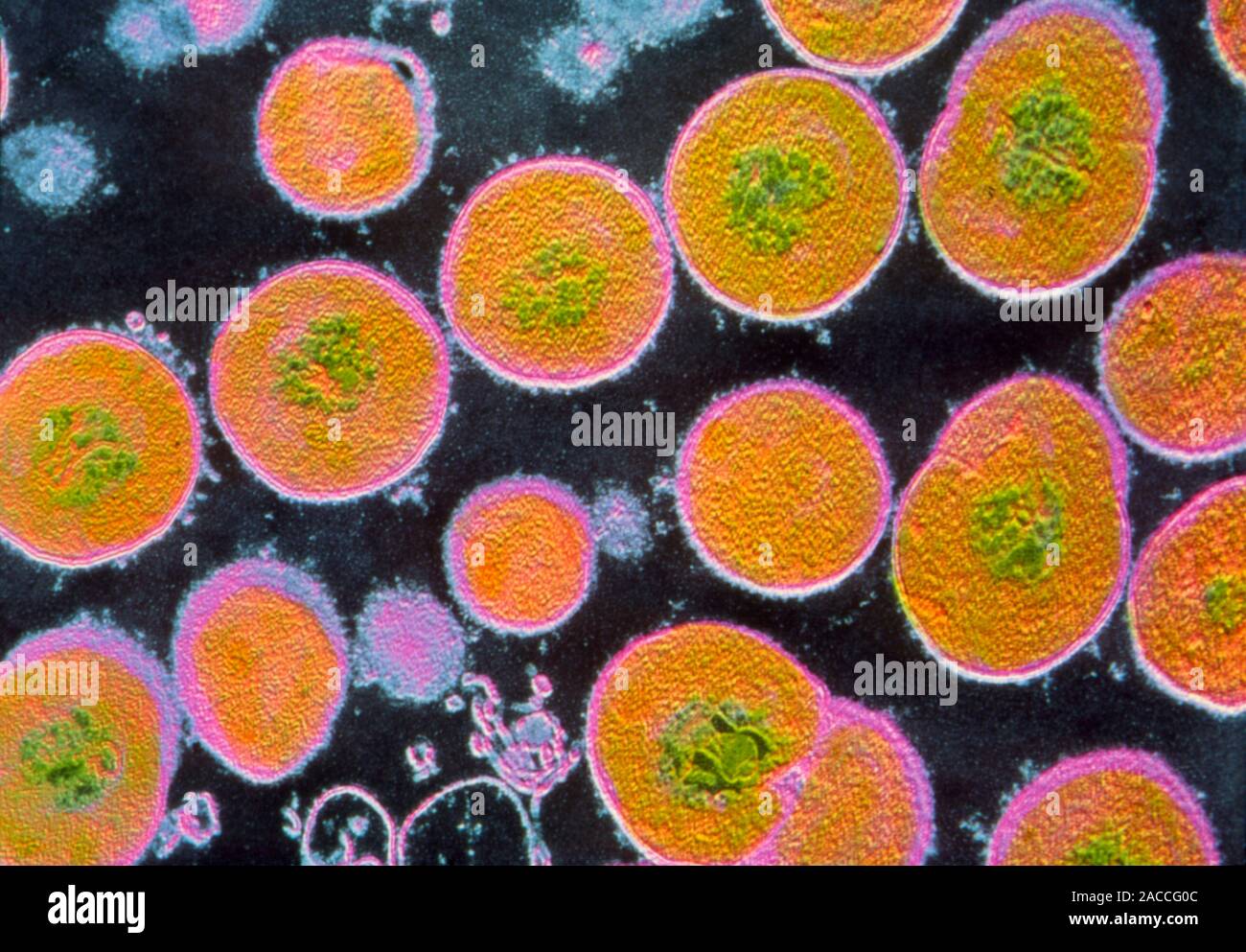 False colour transmission electron micrograph (TEM) of the gram ...