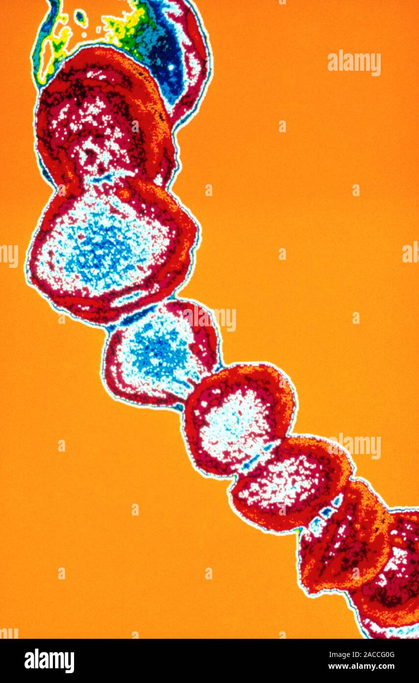 Coloured scanning electron micrograph of the gram- positive bacteria ...