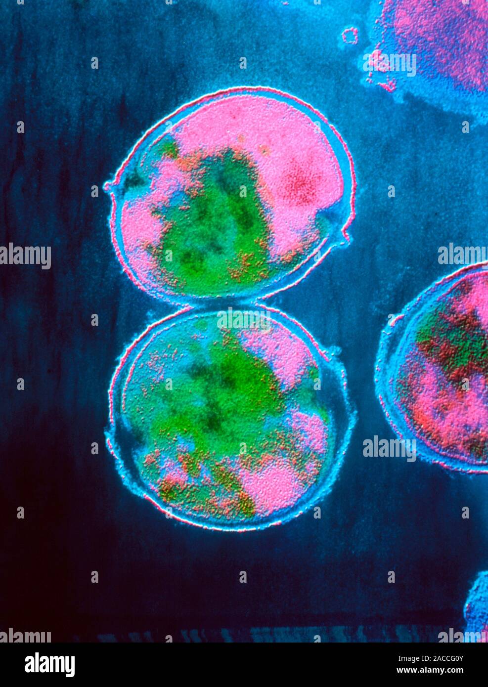 False-colour transmission electron micrograph (TEM) of Streptococcus ...