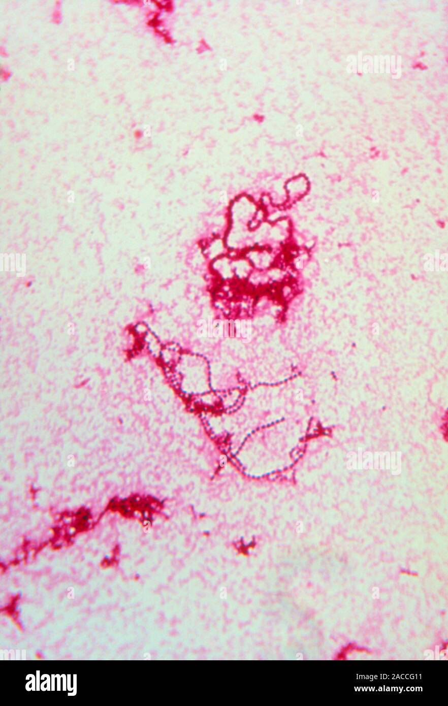 Light Micrograph Of Colony Of Streptococcus Pyogenes A Species Of Gram Positive Non Motile