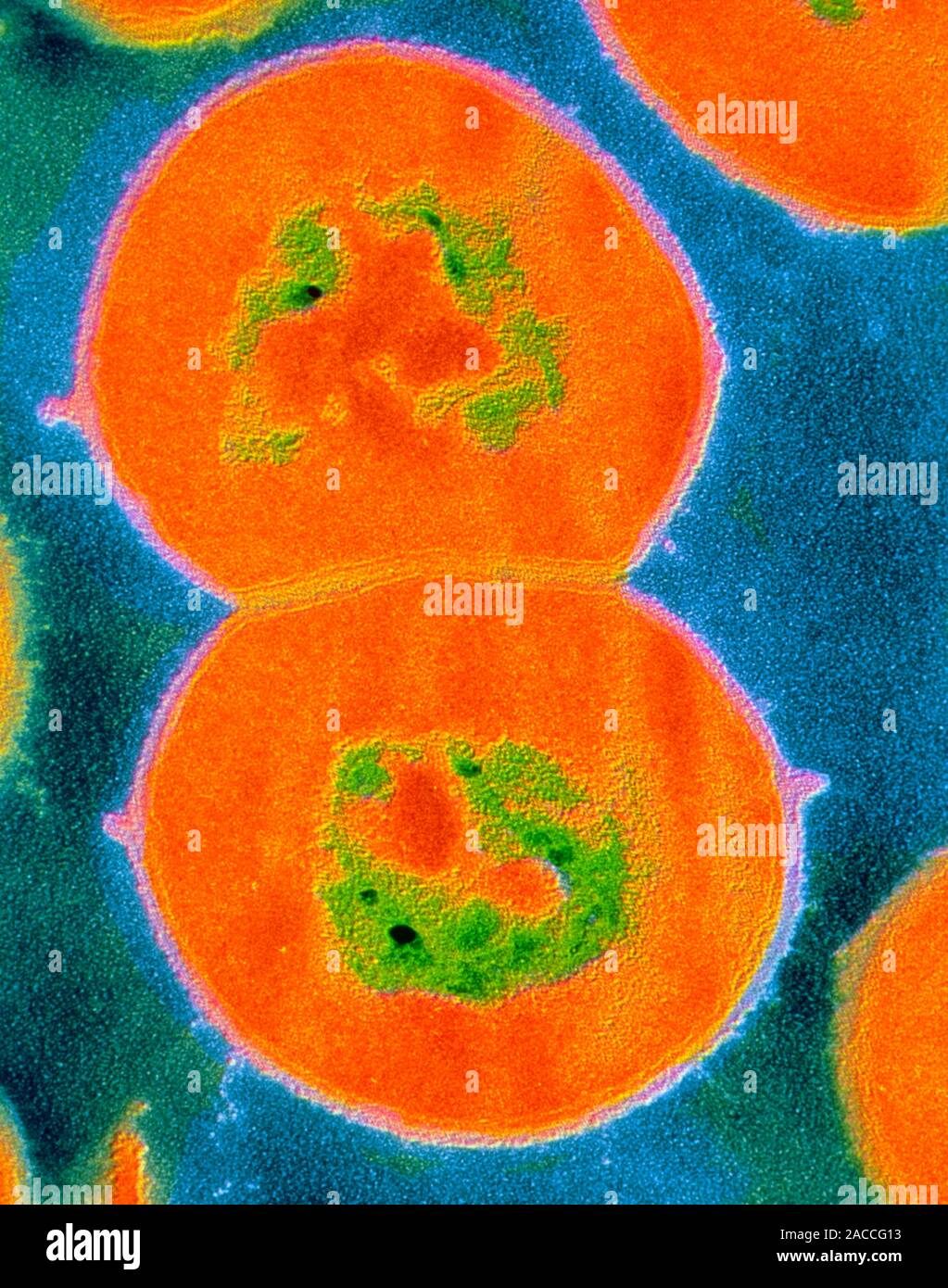 False-colour transmission electron micrograph (TEM) of a colony of the ...