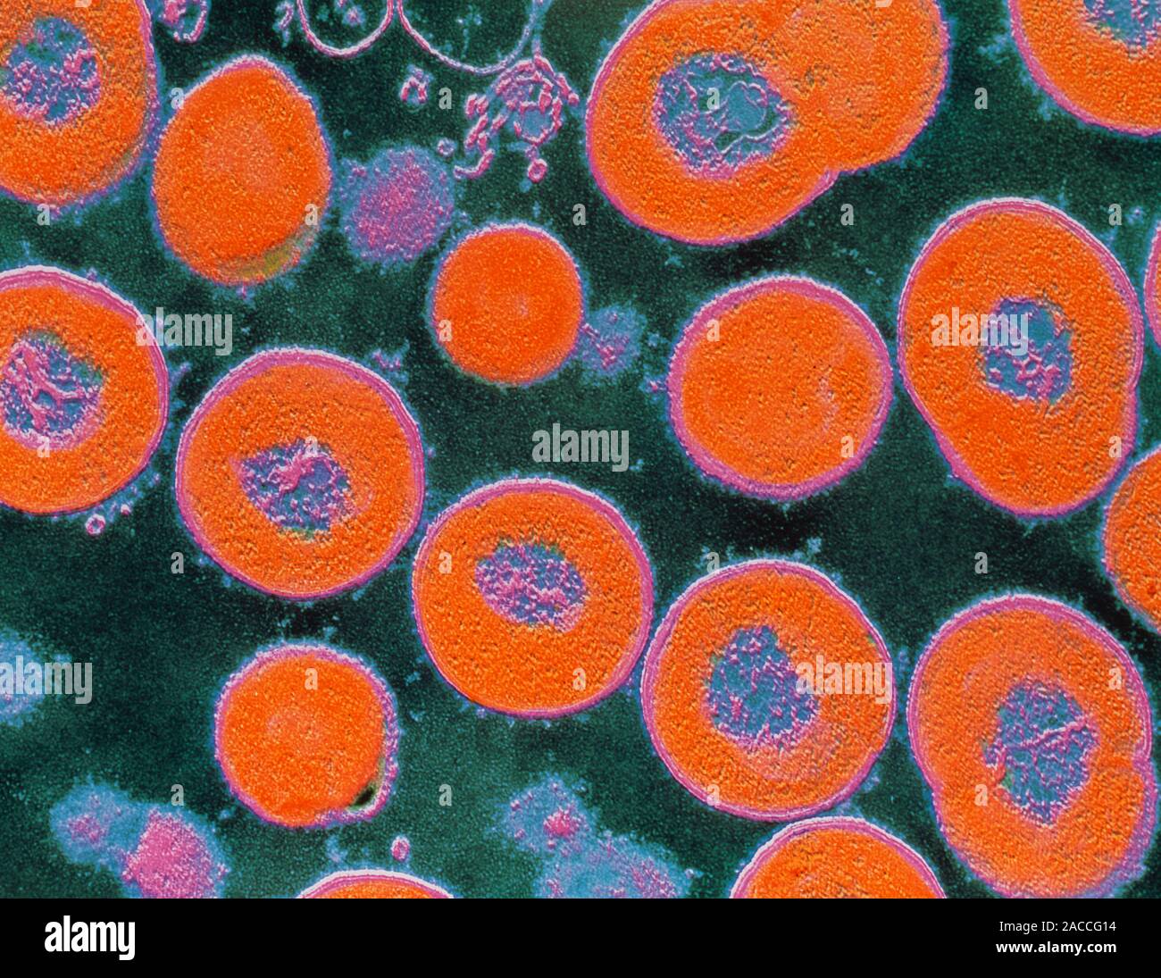 Transmission electron micrograph (TEM) of the gram-positive bacteria ...