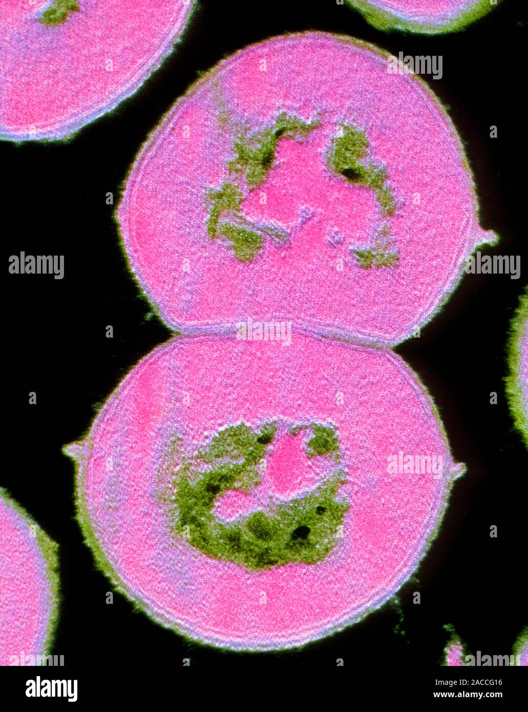 False-colour transmission electron micrograph (TEM) of a colony of the ...