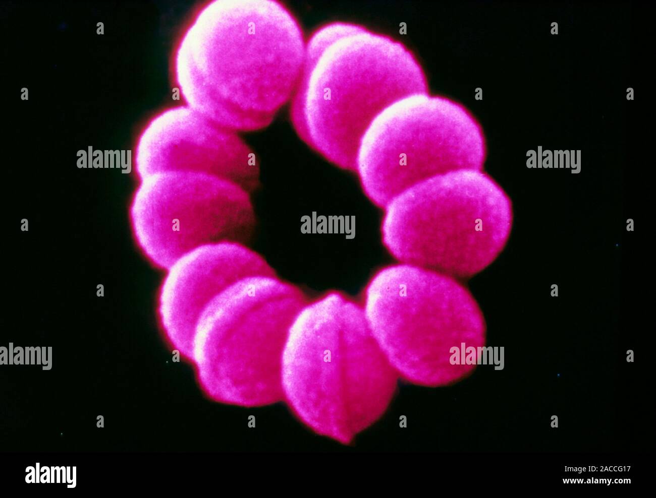 False-colour scanning electron micrograph (SEM) of Streptococcus sp ...