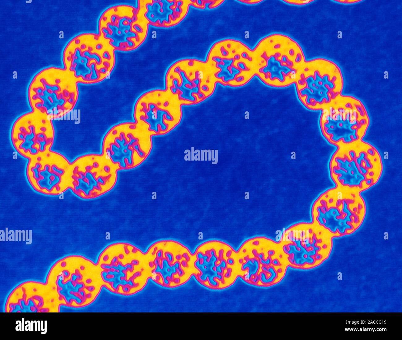 Streptococcus pyogenes. Coloured transmission electron micrograph (TEM ...
