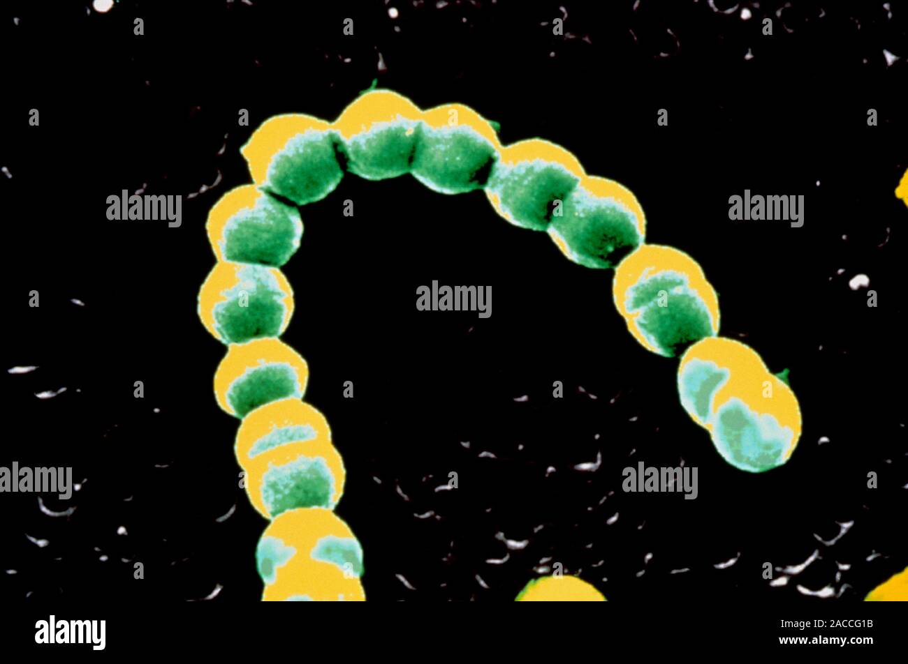 Streptococcus Bacteria Coloured Scanning Electron Micrograph Sem Of Streptococcus Type A