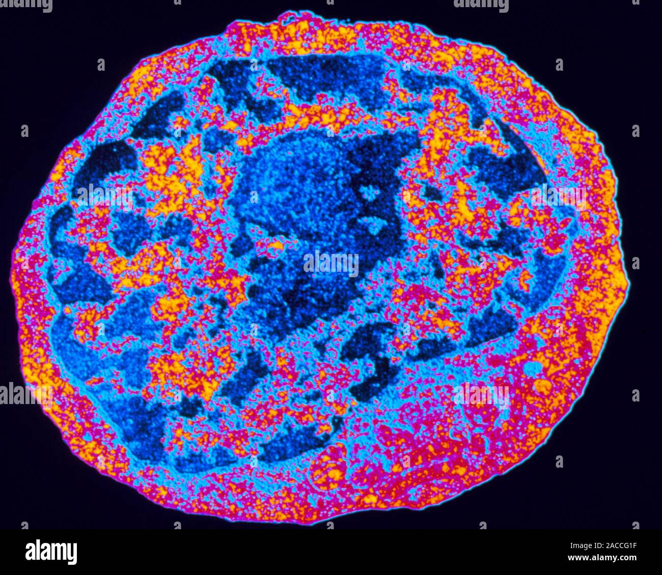 Streptococcus Lactis