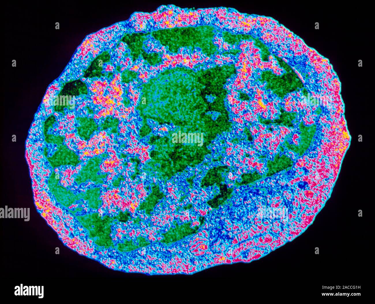 Coloured transmission electron micrograph (TEM) showing a Lactococcus ...