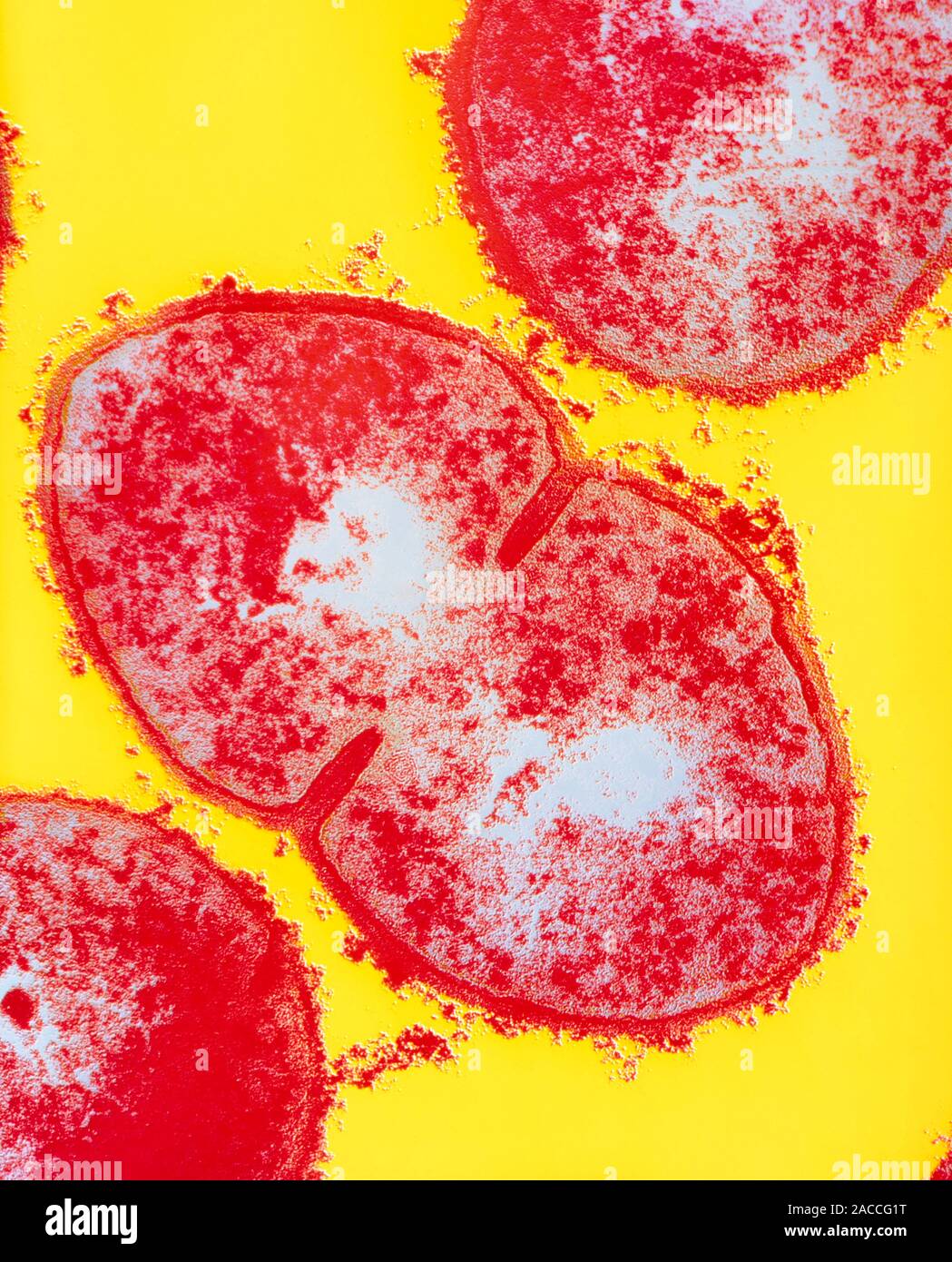 Resistant Streptococcus Strain Coloured Transmission Electron Micrograph Of A Dividing