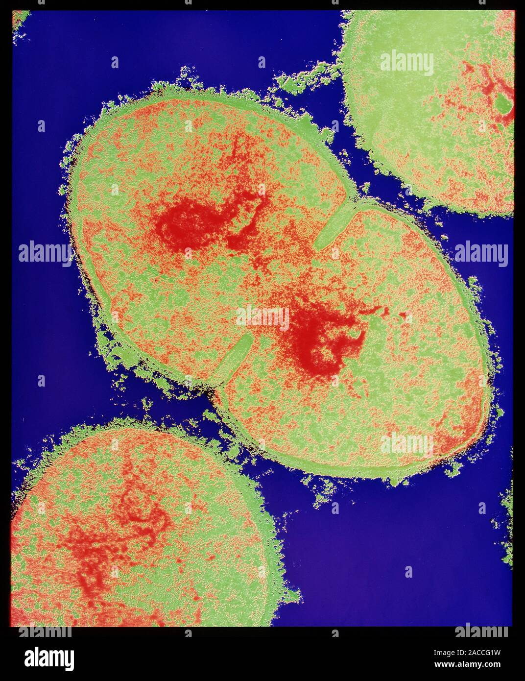 Resistant Streptococcus strain. Coloured transmission electron ...