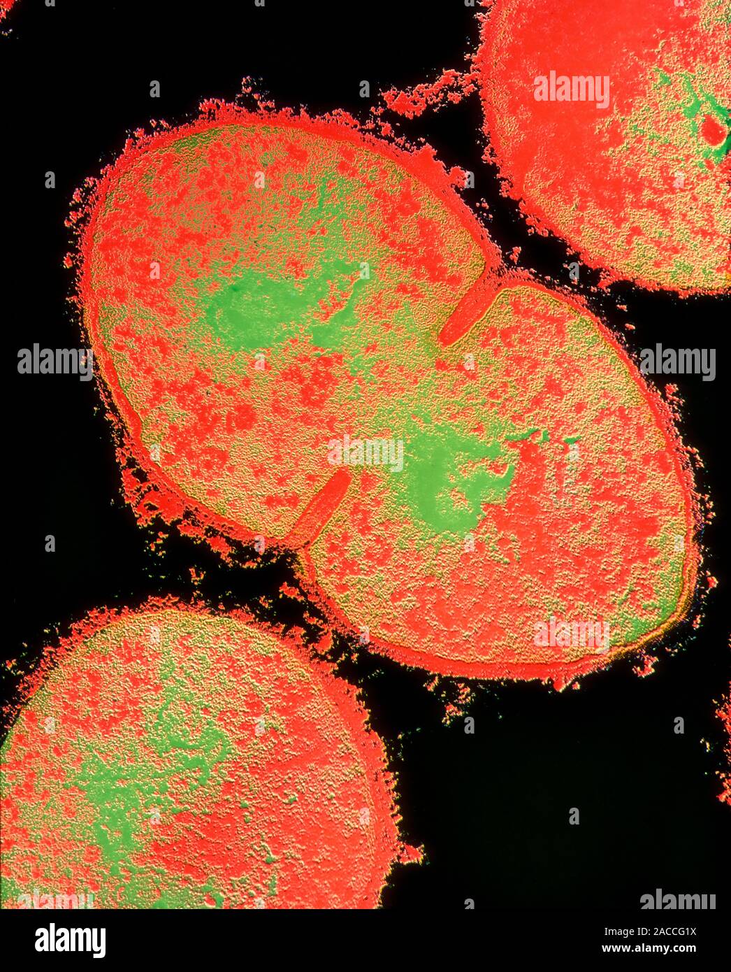 Resistant Streptococcus strain. Transmission electron micrograph of a ...