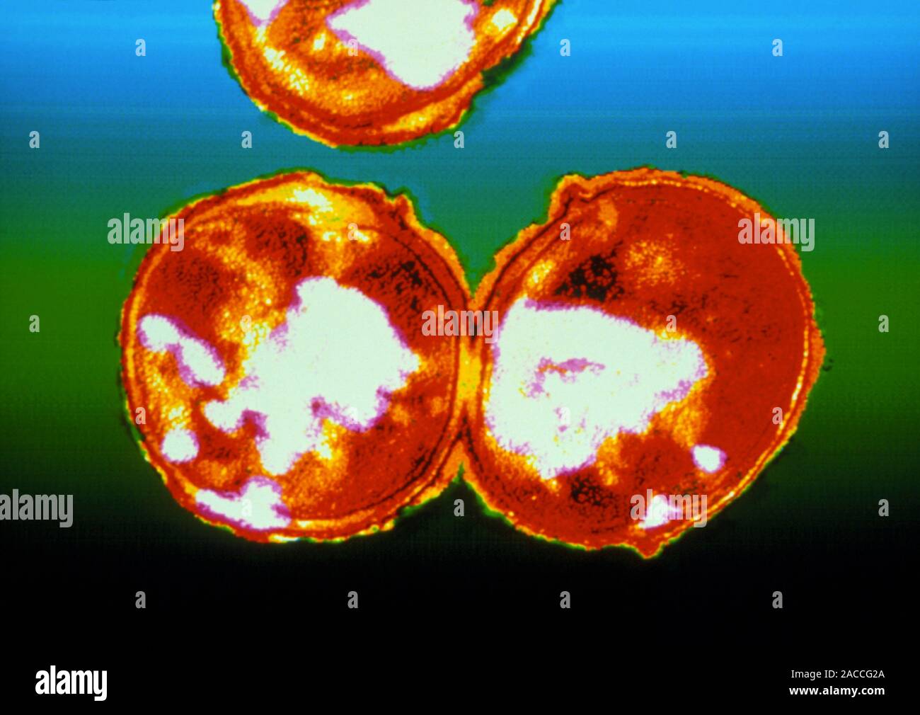 Streptococcus Pneumoniae Coloured Transmission Electron Micrograph Tem Of A Section Through A
