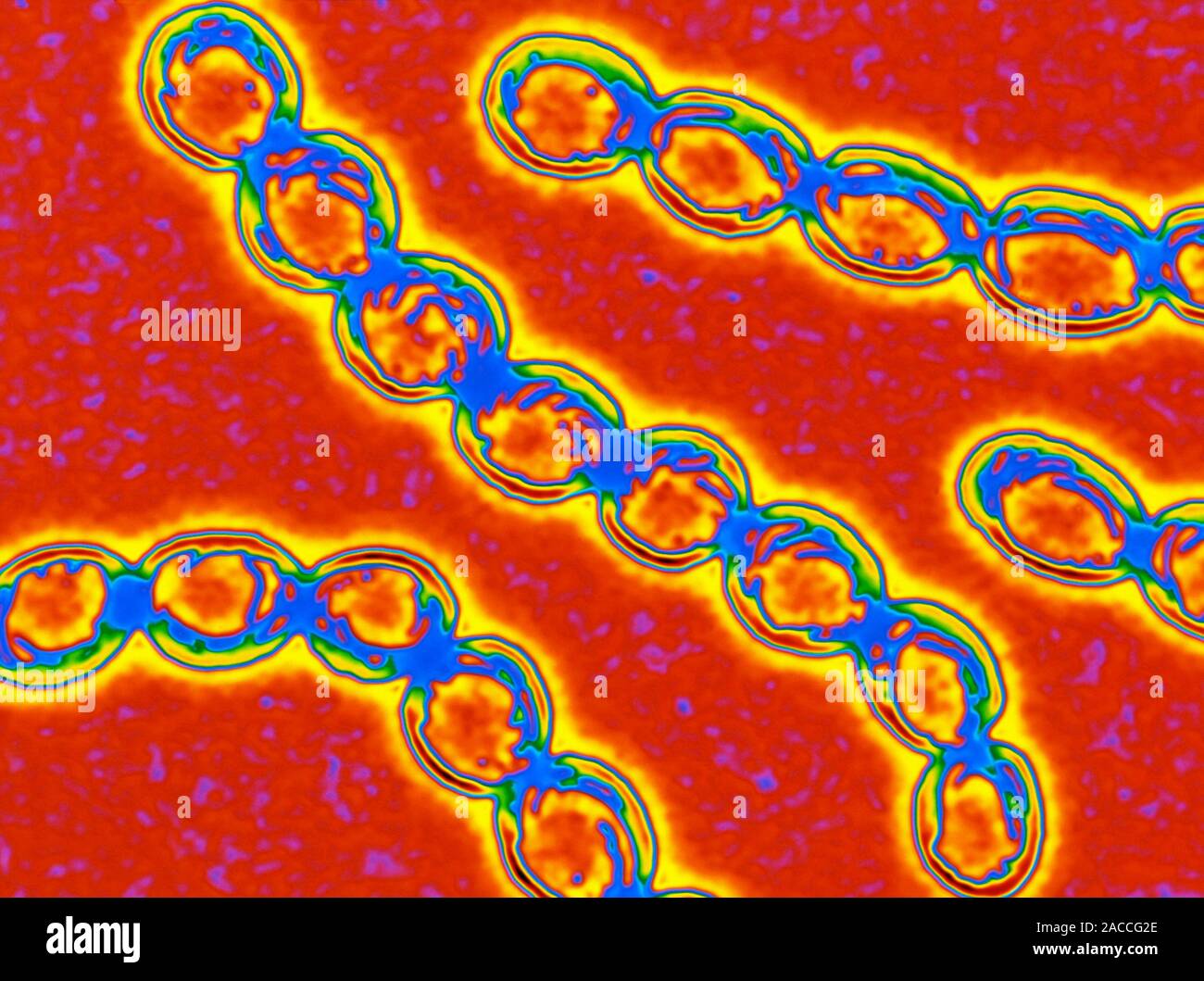 Streptococcus Bacteria Coloured Transmission Electron Micrograph Tem Of Chains Of Bacteria