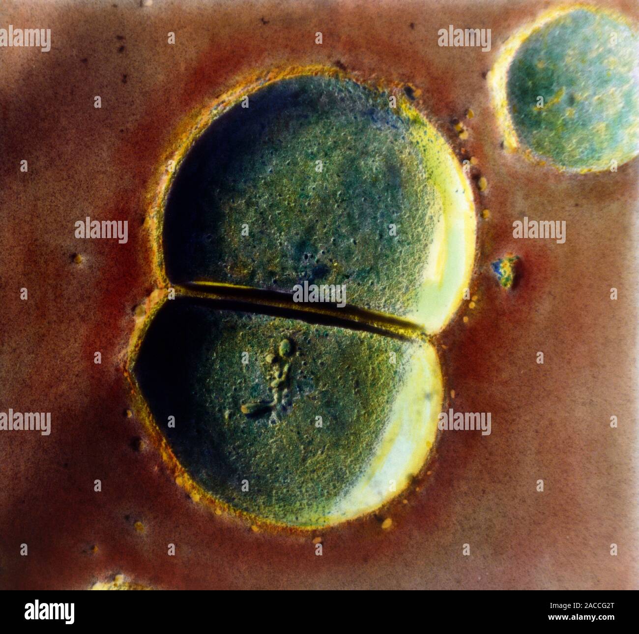 Streptococcus bacterium. Coloured transmission electron micrograph (TEM ...